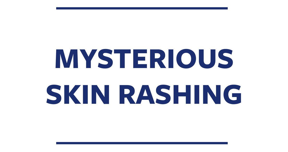 Mysterious Skin Rashing